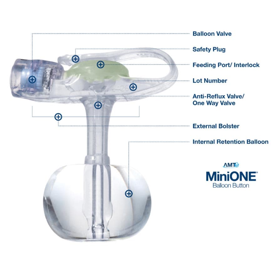 AMT MiniONE Enfit Low Profile Balloon Button G-Tube Kit