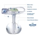 AMT MiniONE Enfit Low Profile Balloon Button G-Tube Kit