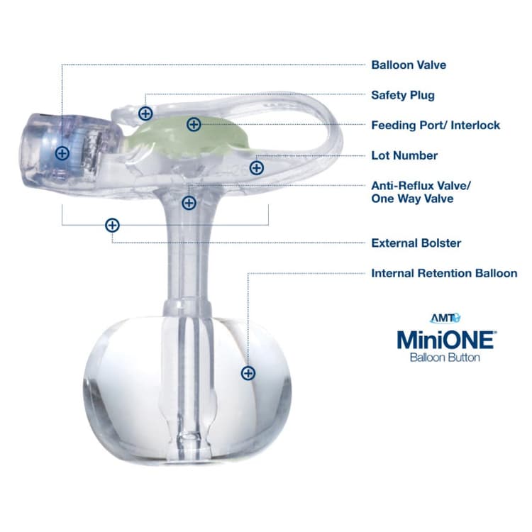 AMT MiniONE Enfit Low Profile Balloon Button G-Tube Kit